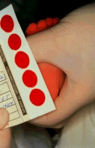 Archived Guthrie Cards Find a New Purpose | Labcompare.com