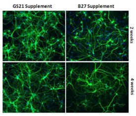 AMSBIO Launches Neural Supplement | Labcompare.com