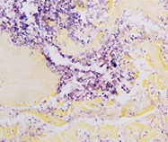 Ventana Launches Fully Automated Gram Stain on the BenchMark Special ...