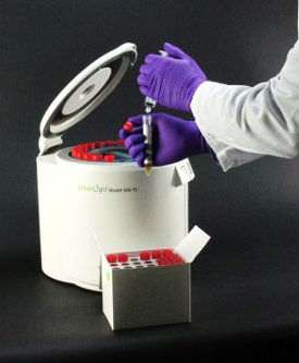 MOCON adds rapid 'indicator organism' testing to GreenLight food safety ...