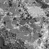 High Throughput Serial Block Face Imaging with JEOL FE SEM and Gatan ...