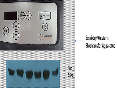 | Labcompare Product Review. The Best Western Transfer Apparatus ...