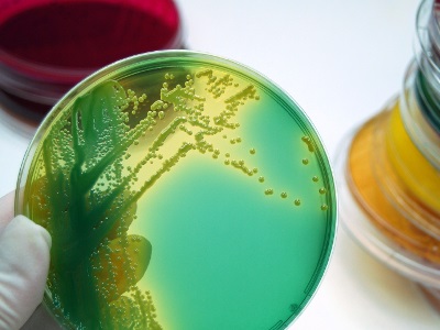 Using Advanced Data-Management Solutions to Ensure Food Safety ...