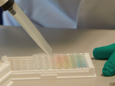 Manufacturing Considerations for IVD Reagents Used in Clinical ...
