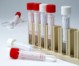 Thermo Fisher Scientific Introduces Primary Collection Tubes for ...
