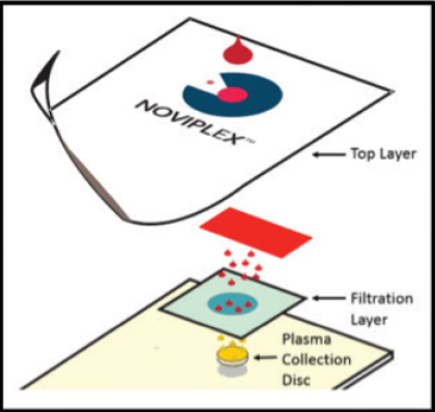 A Disruptive Sampling Technology: Interview With Tim Schlabach of ...
