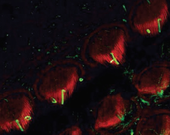 The Power of Modern Super-Resolution Microscopy | Labcompare.com
