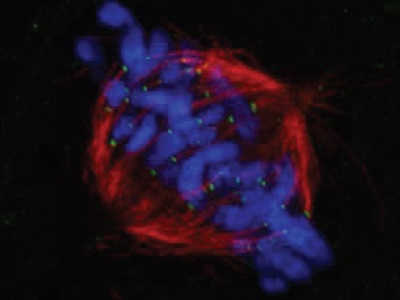 The Power of Modern Super-Resolution Microscopy | Labcompare.com