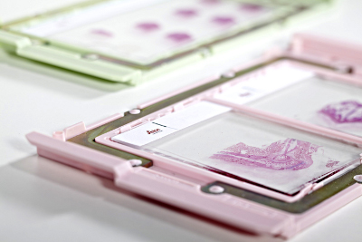 Leica Microsystems Introduces Extra Large Slide Scanning for Digital ...