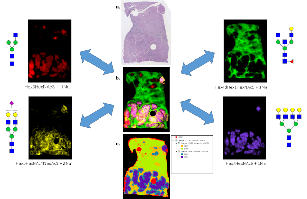 MALDI Imaging Reveals Translational Cancer Biomarkers | Labcompare.com