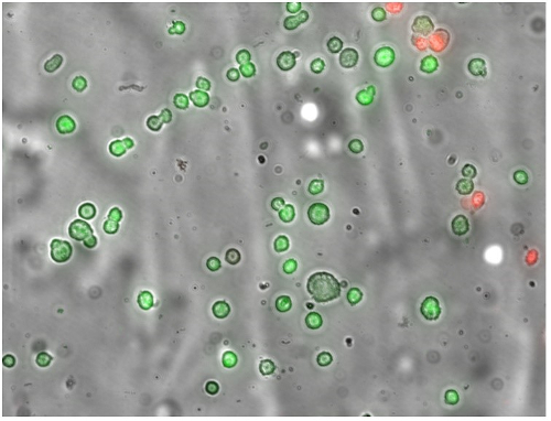 Investigating Intracellular Ice Formation with Cryomicroscopy ...