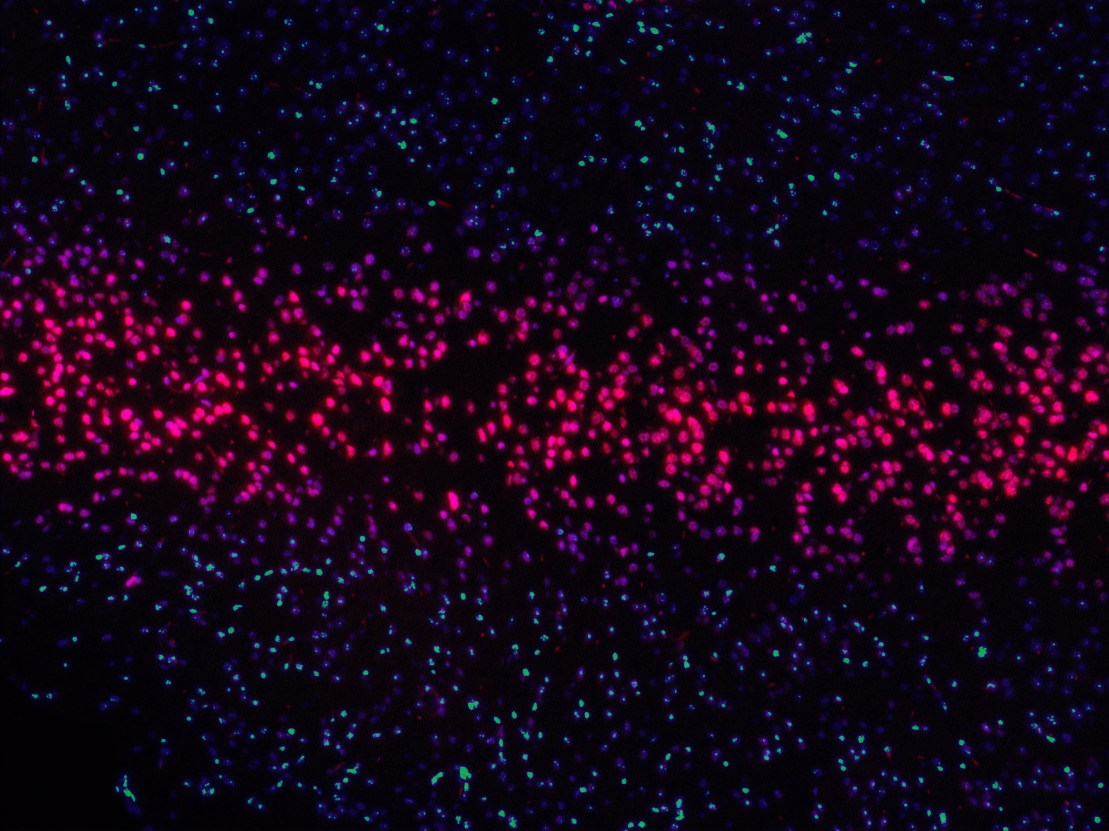 Cell Culture Clarification and Sterile Filtration: Combining Two Steps ...