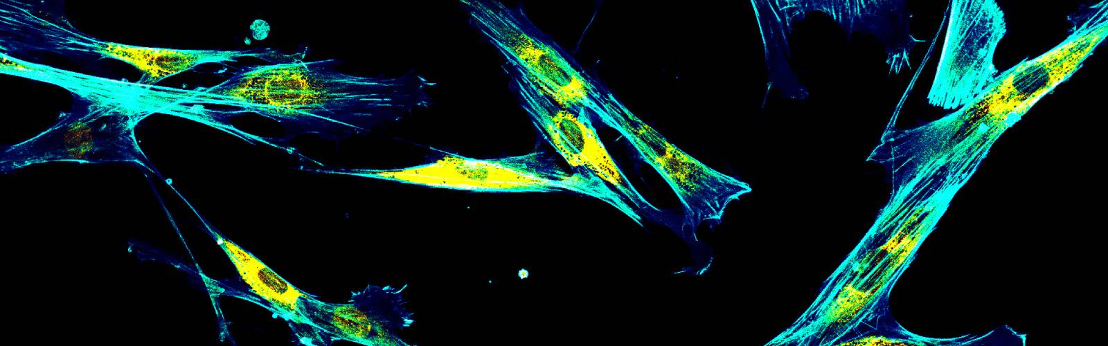How to Reduce Autofluorescence | Labcompare.com