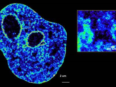 Researchers Image Chromatin Loops, Find Transcription Aids Supercoiling ...