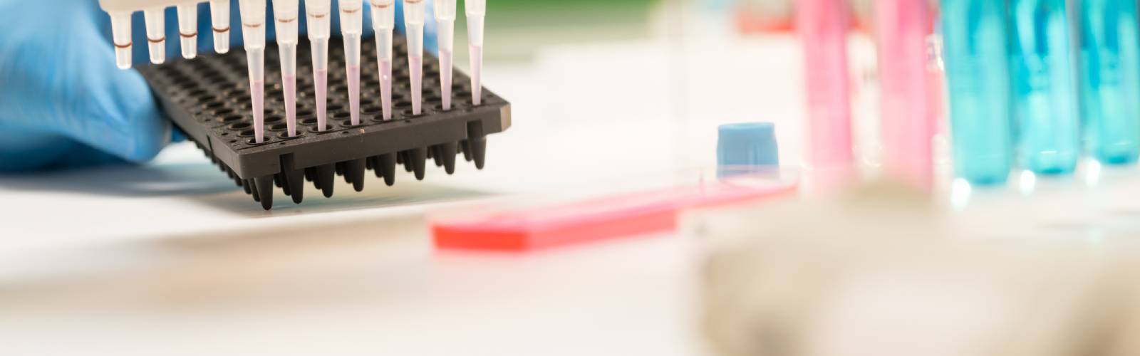 Product Roundup: NGS Library Prep Kits | Labcompare.com