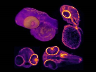 Optical Coherence Tomography Enhanced for Powerful 3D Microscopy ...