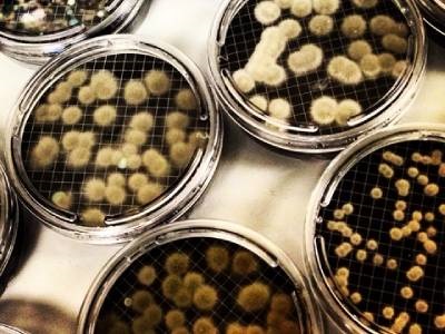 Membrane Filtration: Advantages and Modern Advancements | Labcompare.com