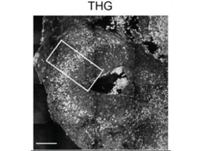 Advanced Live Cell Imaging Technique Yields Rett Syndrome Insights ...