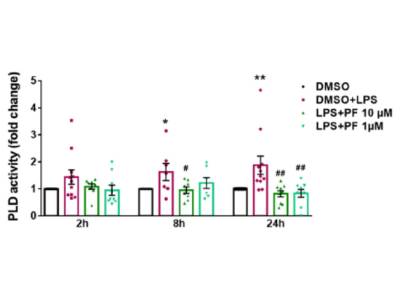 | Labcompare Product Review. Easy Detection of PLD Activity but with ...