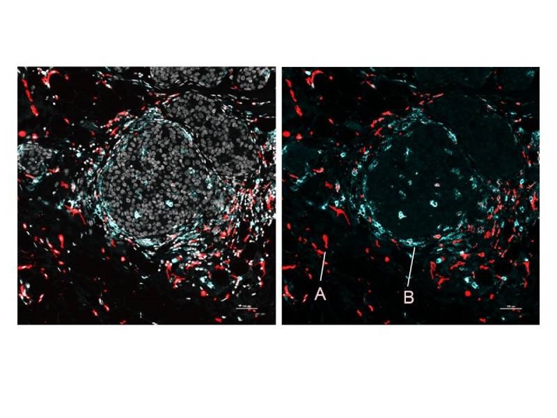 New Method Integrates Spatial Transcriptomics and Proteomics ...