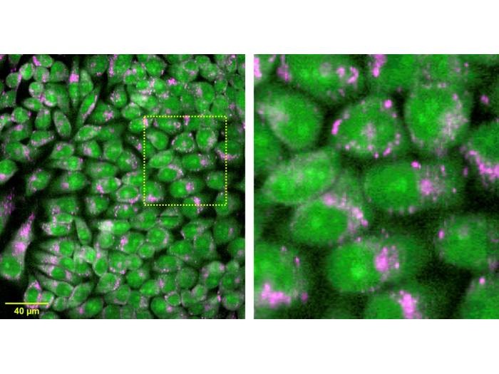 New Raman Microscopy Approach Is 100s of Times Faster Than Conventional ...
