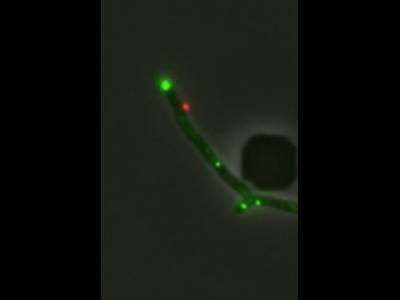 Live-cell Imaging Reveals How Bacteria Resist Phages | Labcompare.com