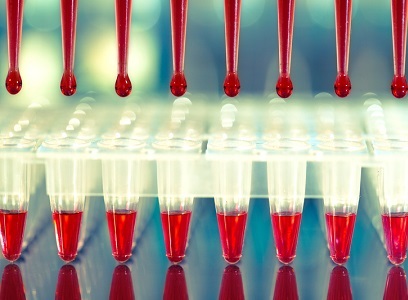 LABTips: Sample Prep for DNA Extraction | Labcompare.com