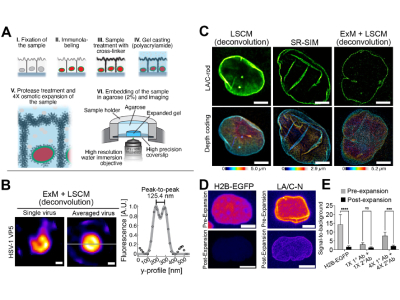 Nano Force Sensors Developed to Measure Intracellular Forces ...