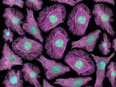 Microtubule Regulation Mechanism Discovered | Labcompare.com