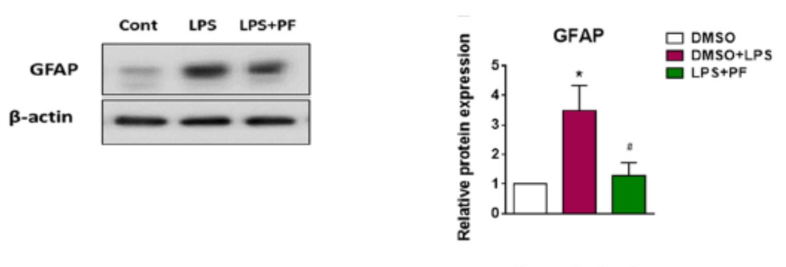 | Labcompare Product Review. Detection of GFAP in A Mouse Model of ...