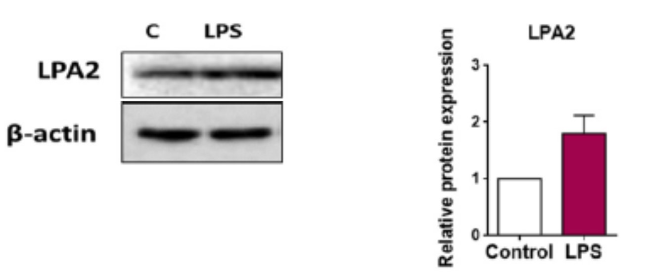 | Labcompare Product Review. A Good Antibody for LPA2 Studies ...