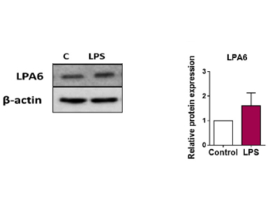 | Labcompare Product Review. Detection of LPA Receptor 6 In Microglia ...