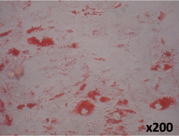 | Labcompare Product Review. Oil-red-O Staining for Lipid Vacuole ...