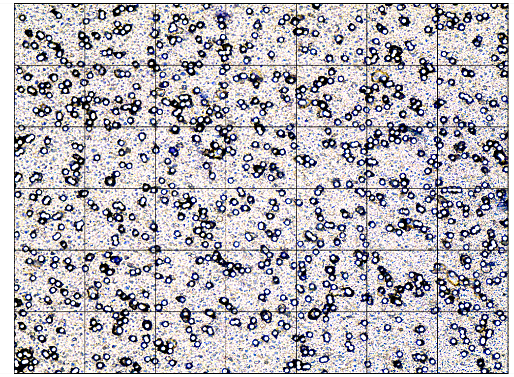 | Labcompare Product Review. Measuring Cell Mobility Using Transwell ...