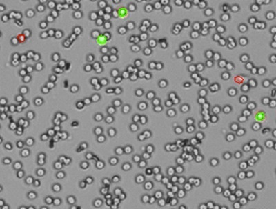 Buyer’s Guide: Automated Cell Counters | Labcompare.com
