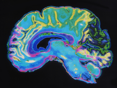 Researchers Reveal How HSV-1 Infiltrates The Nervous System ...