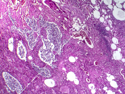 Research Demonstrates How Fibroblastic Reticular Cells Protect And ...