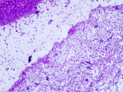 Virtual Gram Staining Method Provides Real-Time Analysis of Label-Free ...