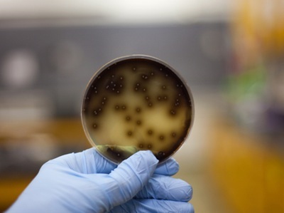 Colony Picker: Manual vs Automated for Microbial Research | Labcompare.com