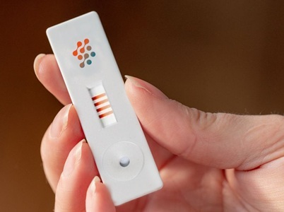 Advancing Biomarker Technology to Increase Early-stage Cancer Diagnostics | Labcompare.com