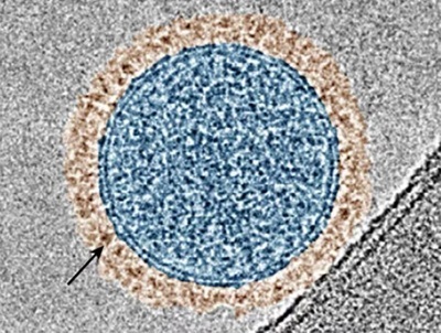 Inhalable Therapy Delivers Cancer-fighting Proteins Directly to the ...