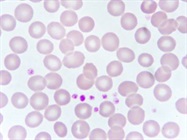 Platelet Aggregation Systems (Aggregometer)