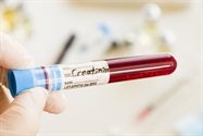 Creatinine Analyzer | Labcompare.com