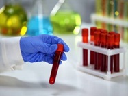 Nephelometer / Microplate Nephelometry Reader | Labcompare.com