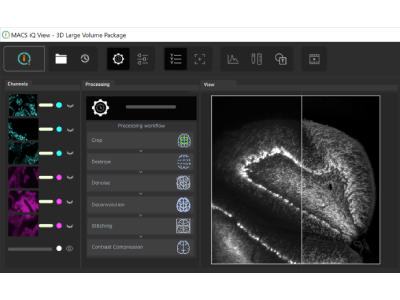 UltraMicroscope Blaze™ Light Sheet Microscope from Miltenyi Biotec ...