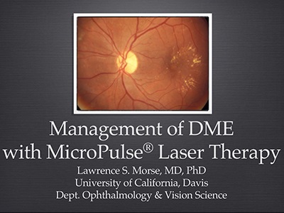 Management of DME with MicroPulse® Laser Therapy