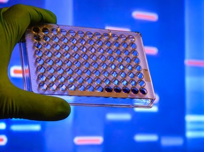 STRmix Launches New Version of DBLR Application for DNA Evidence