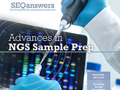 Advances in NGS Sample Prep